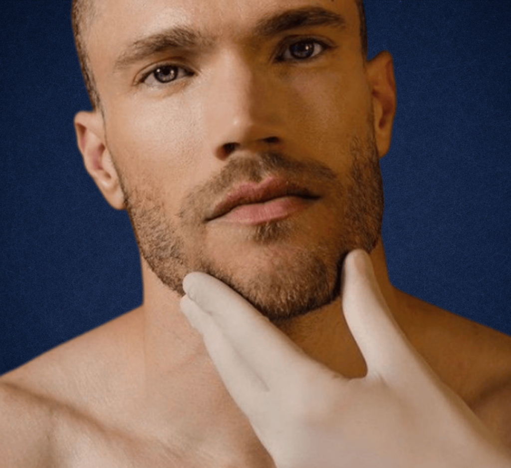 Male Chin Implants in Frisco | SCULPT Aesthetic Center