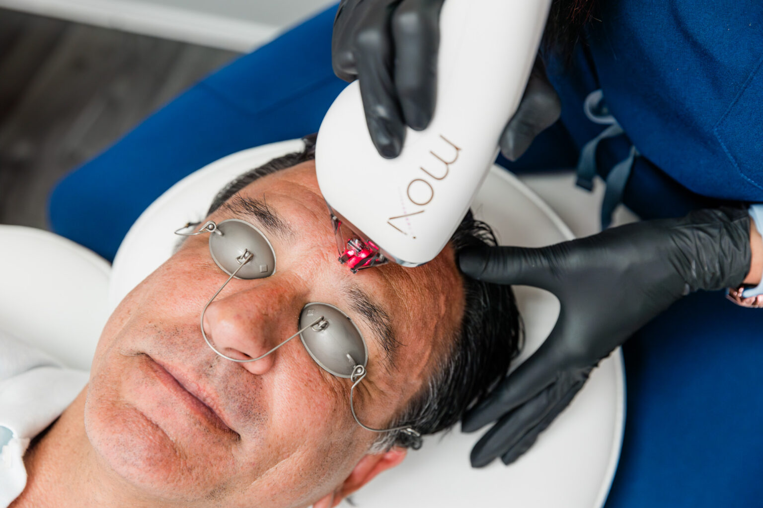 Laser Skin Rejuvenation For Men in Frisco | SCULPT Aesthetic Center