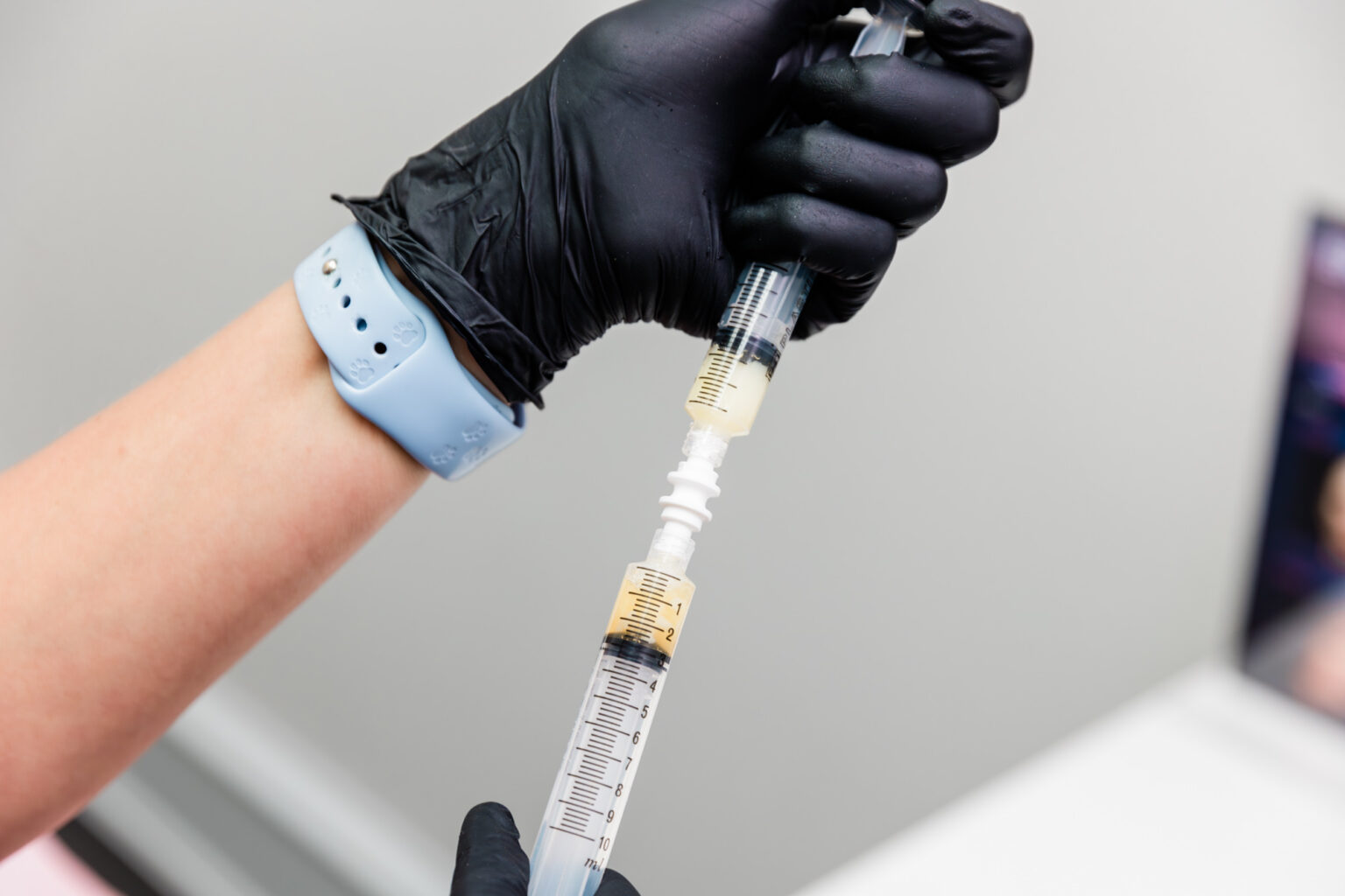 PRP Injections in Frisco | SCULPT Aesthetic Center